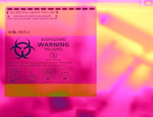 Treatment of extravasation of therapeutic radiopharmaceutical injection