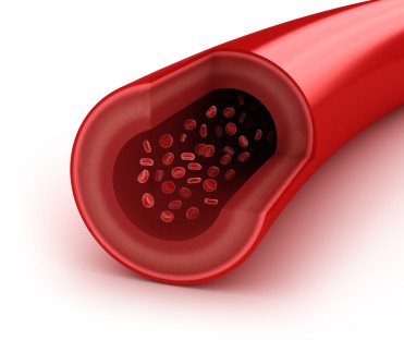 How To Reduce Vancomycin Induced Infusion Phlebitis