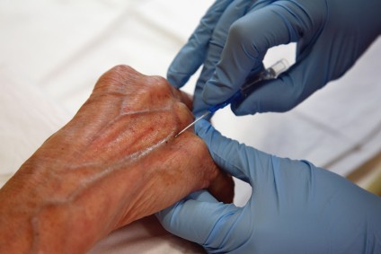 Reducing antecubital fossa peripheral IV cannulation