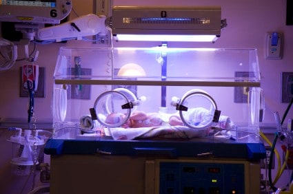 Extended dwell peripheral IV catheter for neonatal vascular access