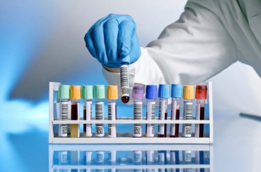 Collecting blood specimen through existing IV