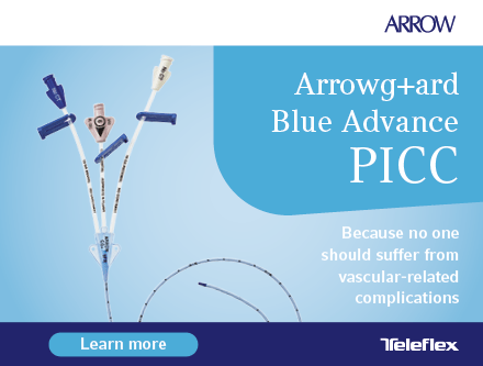 IV catheter embolism - Full Text